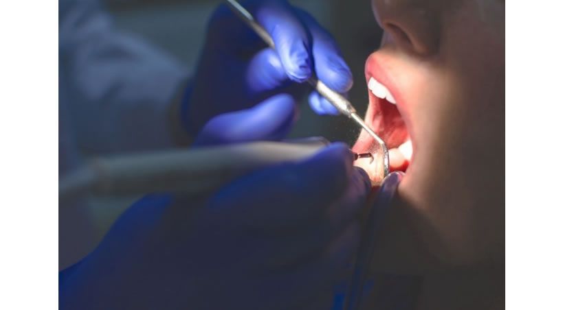 Diagnóstico del "Síndrome de la boca ardiente" - Odontologos.com.co