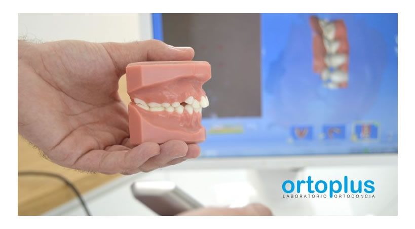 Escáner intraoral: ¿Por qué tener uno en mi clínica dental ...